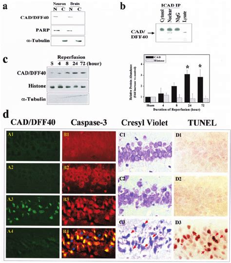 Alterations In Caddff40 Protein Expression After Cerebral Ischemia A