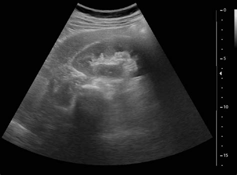 Pattern Matching Algorithms And Their Use In Computer Vision