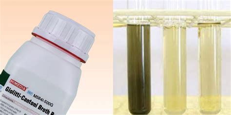 Catalase Test Principle Procedure Result And Application Biology