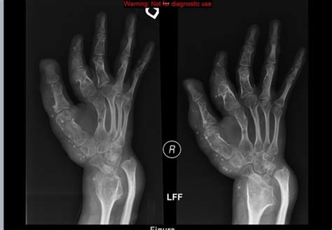 Abfas Foot Flashcards Quizlet