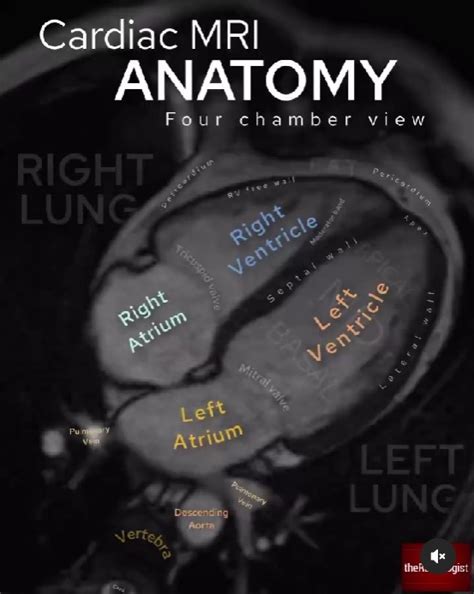 Cardiac Mri Four Chamber View Diagram Diagram Quizlet