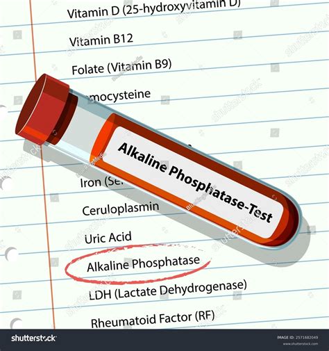 41 Acid Phosphatase Stock Vectors And Vector Art Shutterstock
