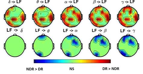 Corrected P Value Topographic Maps For The Dr Vs Ndr Comparison Download Scientific Diagram