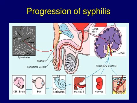 Ppt Curable Versus Incurable Stds Powerpoint Presentation Free