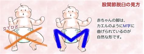 赤ちゃん 股関節 か たい 178255 股関節の痛み 原因 子供 スポーツ
