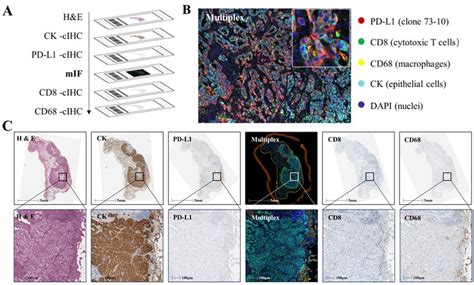Ultivue On Linkedin Biomarkers Spatialbiology Digitalpathology