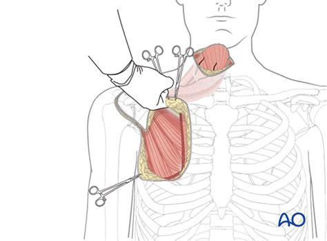 Diagram Pectoralis Diagram Ma Wiringschemacom