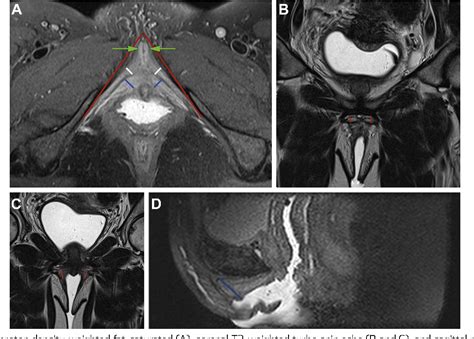 Table From Sexual Anatomy And Function In Women With And Without Genital Mutilation A Cross