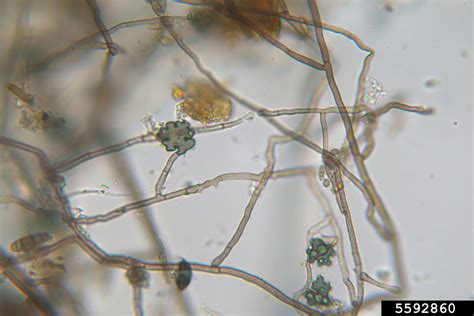 Gaeumannomyces Fungi Genus Gaeumannomyces