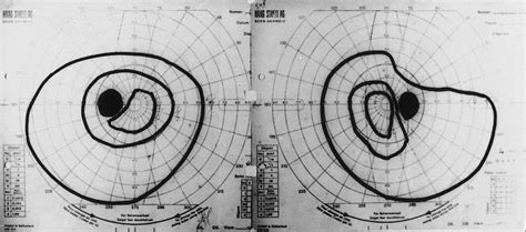 C Ë G Second Case Preoperative Examination Reveals Enlargement Of Download Scientific