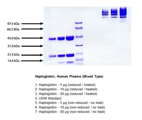 Human Native Haptoglobin From Plasma Proteins And Peptides
