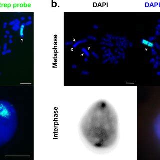 Distribution Of Heterochromatic Blocks Of Sex Chromosomes In Microtus Download Scientific