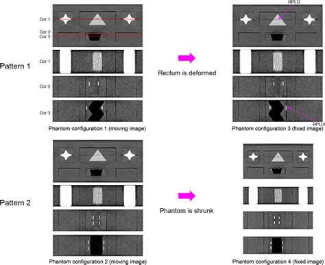 Overview Of Configuration Combination For Each Of The Two Deformable