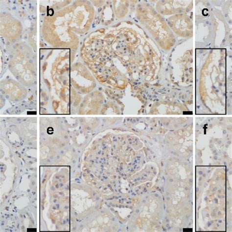 immunohistochemical staining for talin 1 a c three igan patients