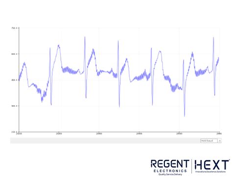 Ad8232 Heart Rate Monitor A Detailed Guide With Arduino Interfacing