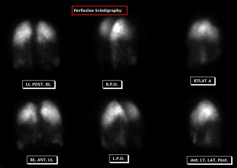 Mir Teaching File Case Vq004