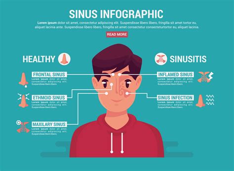 Sinus Vector Art Icons And Graphics For Free Download