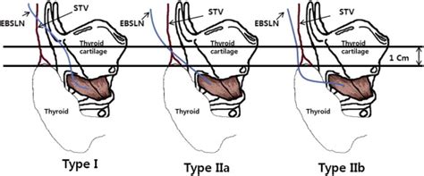 The Anatomy Of The External Branch Of The Superior Laryngeal Nerve In