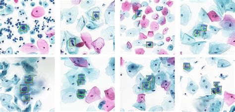 Some Examples Of Abnormal Region Detection Results The Green