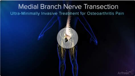 Ultra Minimally Invasive Endoscopic Spine Surgery Specialty Orthopaedics