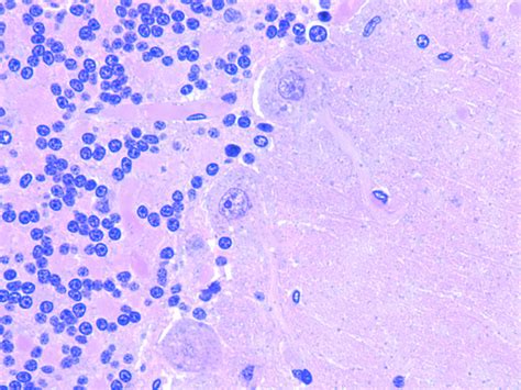 Purkinje Cells