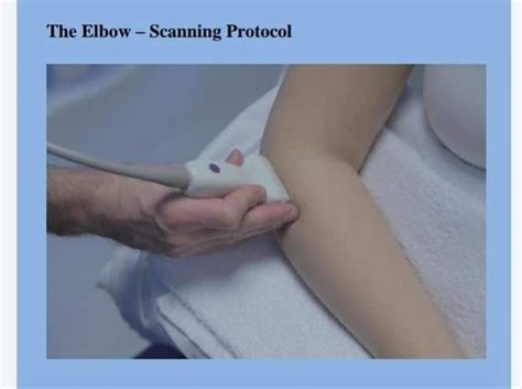 Dr Syed Yousaf Gilani Phd Ultrasound On Linkedin Elbow Ultrasound Protocols