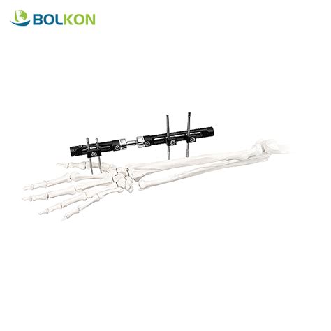 Bone Fracture External Fixator Wrist Elbow Joint Tibial Femoral External Fixation External