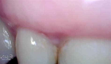 Giantess Brushes Teeth Reverse Endo Pov Türkçe