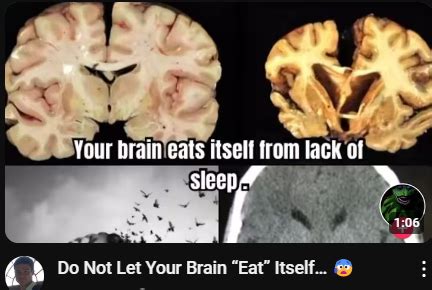 Brain Blank Template Imgflip