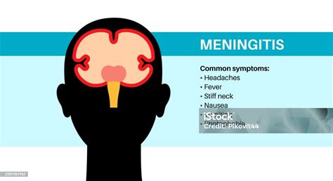 Meningitis Medical Poster Stock Illustration Download Image Now
