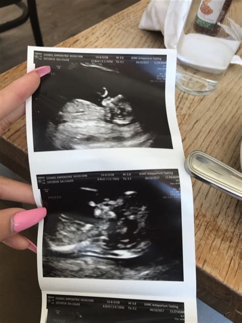 Skull Theory Gender Please Glow Community