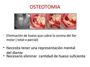 Calaméo Osteotomia