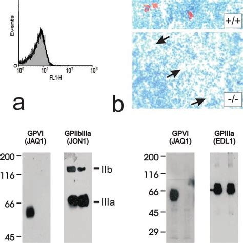 Platelet Aggregation By Collagen Pma And Thrombin In The Presence Of