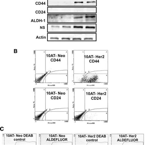 Expression Of Cancer Stem Progenitor Cell Like Marker Proteins In