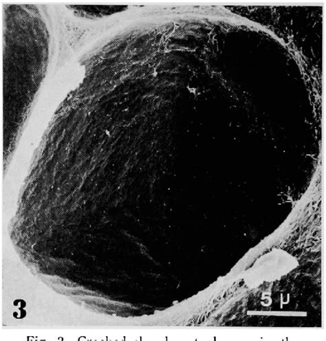 Figure 3 From Scanning Electron Microscopy Of Calcification Of