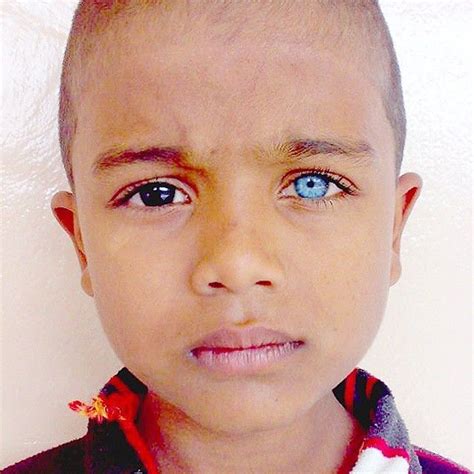 Personas Con Dos Colores De Ojos Distintos Beaux Yeux Yeux Pers Visage