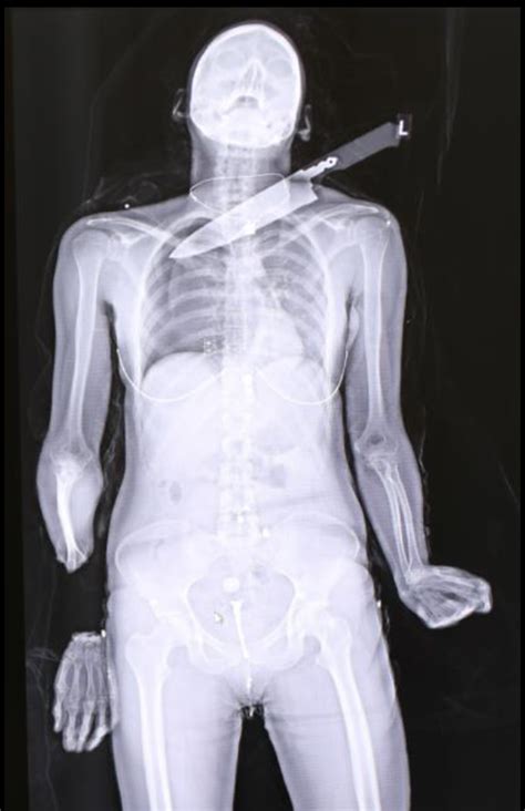 Crime Scene X Ray LEB