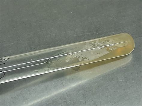 Bal Sample Vs Sputum Sample Key Differences