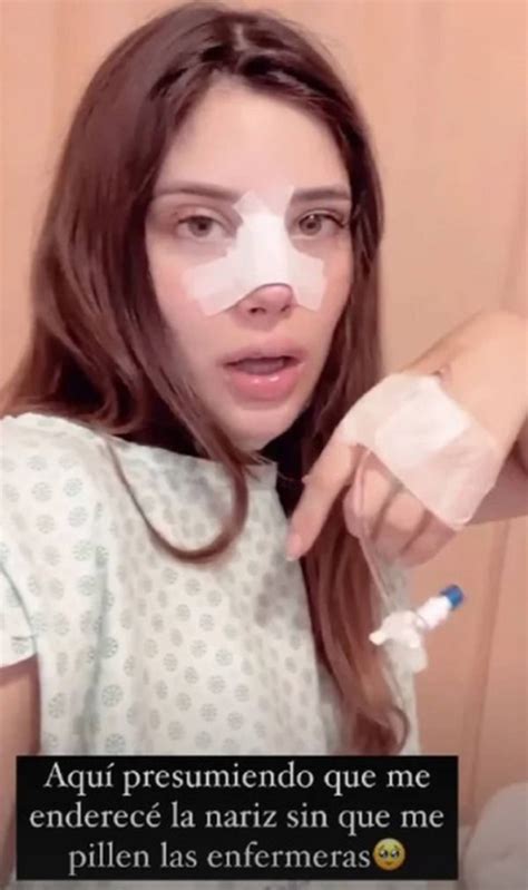 'Aquí presumiendo': Revelan impactante cambio de iCata luego de operación estética
