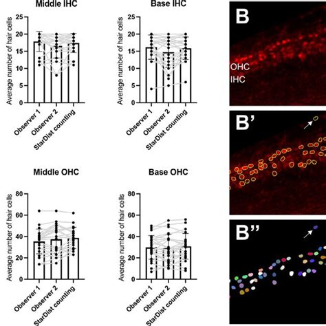 Validation Of Stardist Model In Gentamicin Treated Oc Explants A