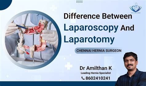 Difference Between Laparoscopy And Laparotomy Chennaiherniasurgeon