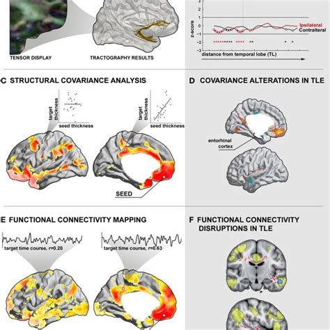 Pdf Imaging Structural And Functional Brain Networks In Temporal Lobe