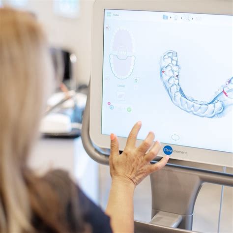 Itero Scanning Ennis Braces