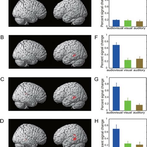 Brain Areas For Audiovisual Sensory Integration That Met The Criterion Download Scientific