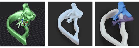 Liver Surgical Phantom Liveraiz