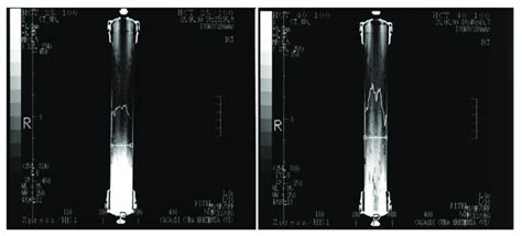 Selected Images Captured For The Conditions Of Hct Left And Download Scientific