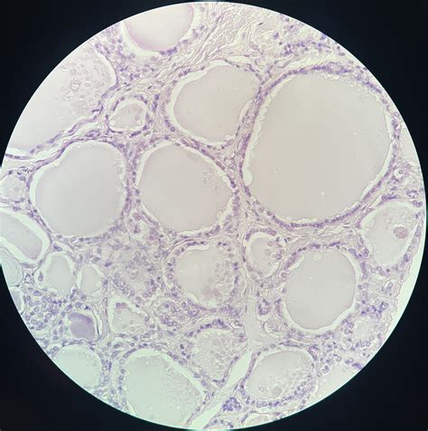 Thyroid Gland Microscope Slides Diagram Quizlet