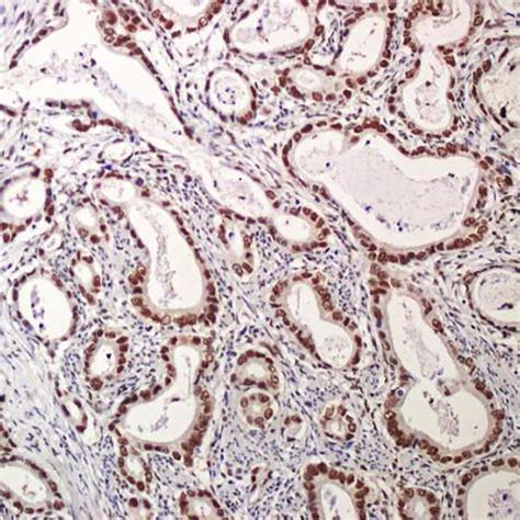 Moderate Arid1a Expression Dabx100 Download Scientific Diagram