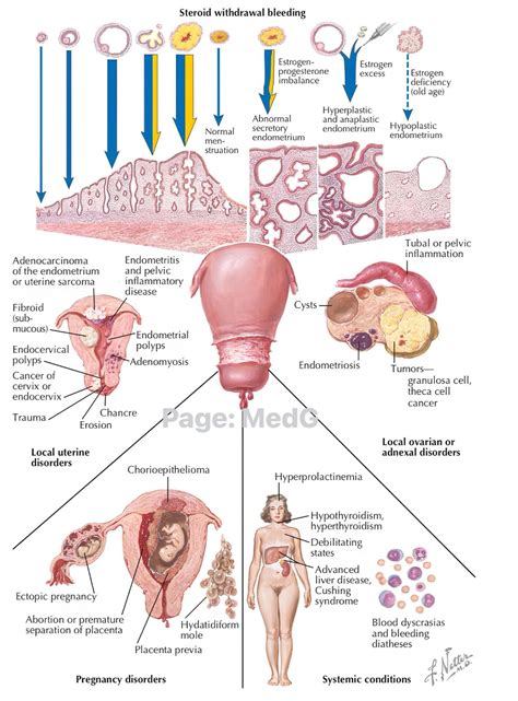 Med Functional And Pathologic Causes Of Uterine Bleeding 1