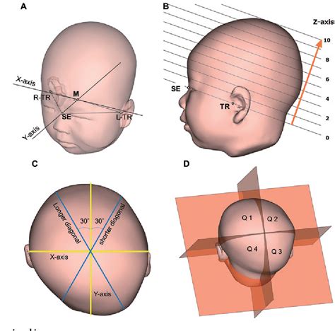 Figure 1 From Reference Values For Cranial Morphology Based On Three